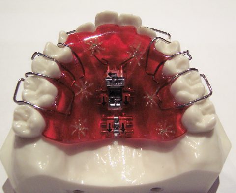 Ortholab – Ortholab Orthodontic Laboratory